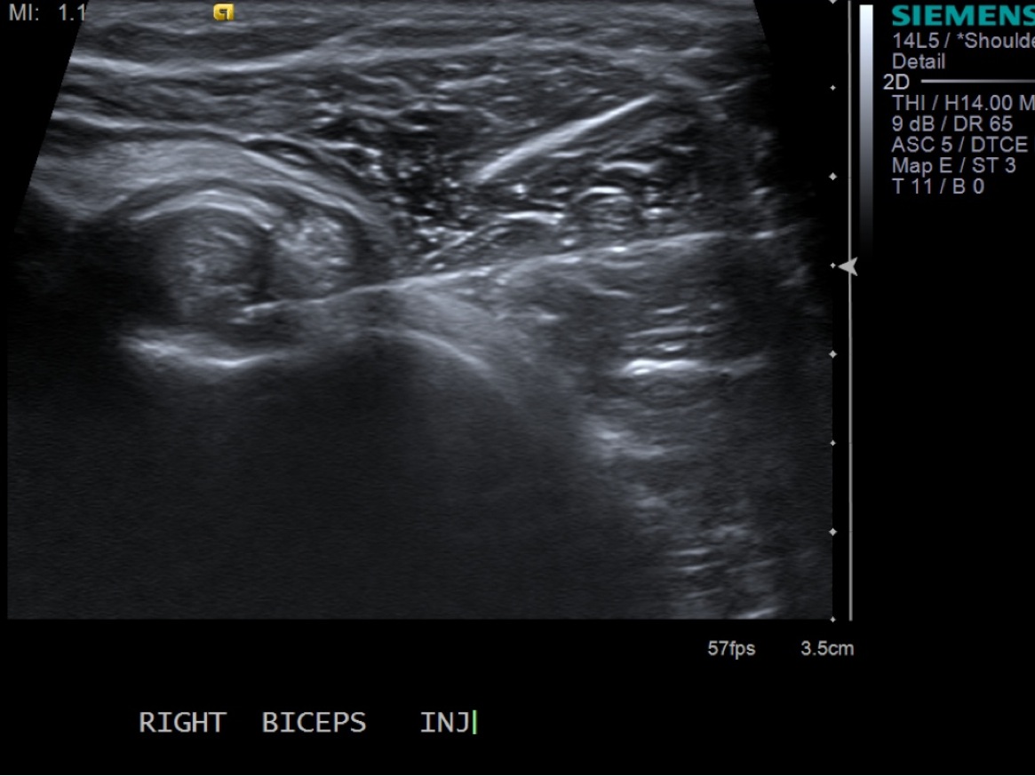 MSK Ultrasound Procedures